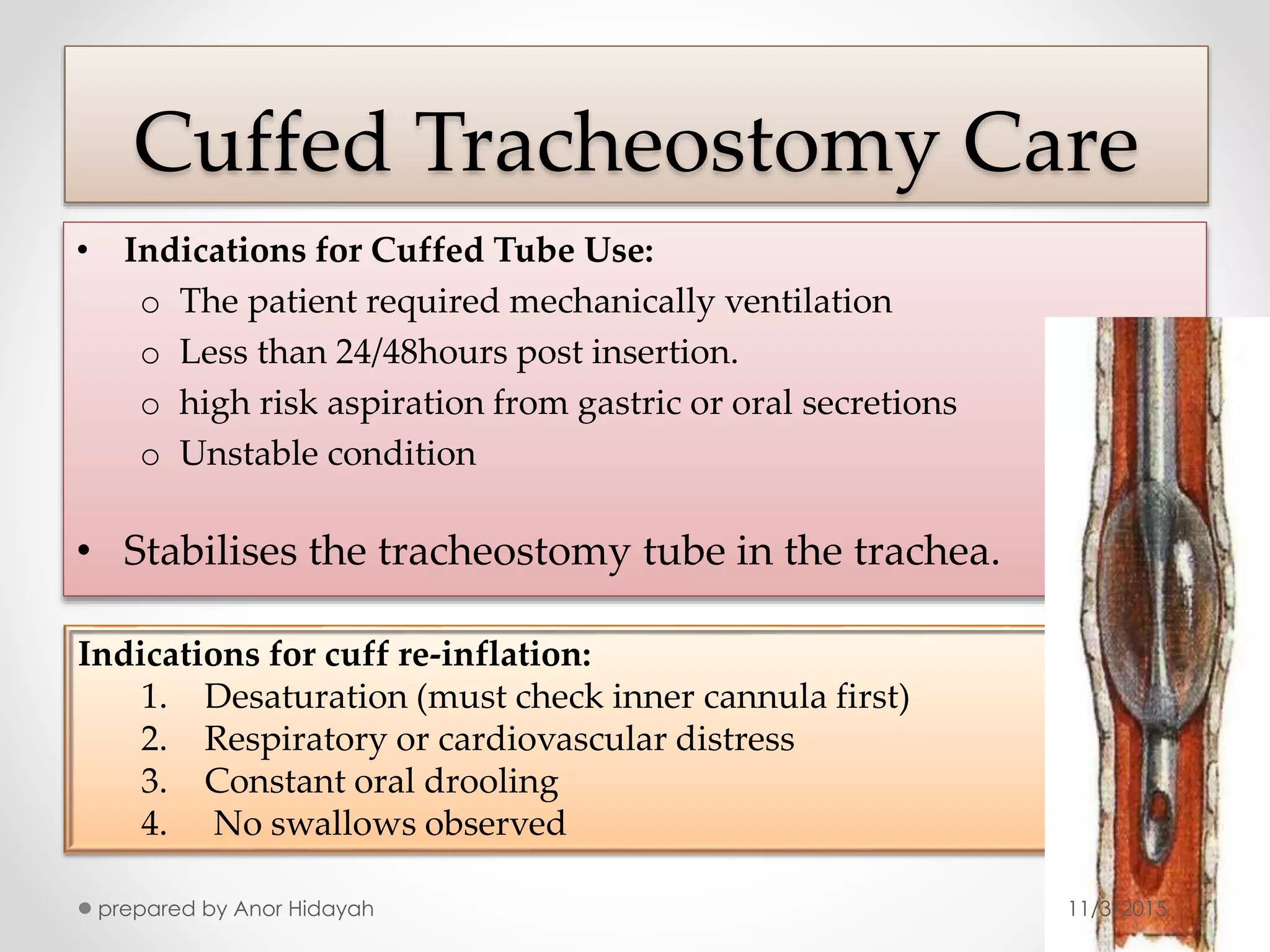 Percutaneous tracheostomy | PPTX