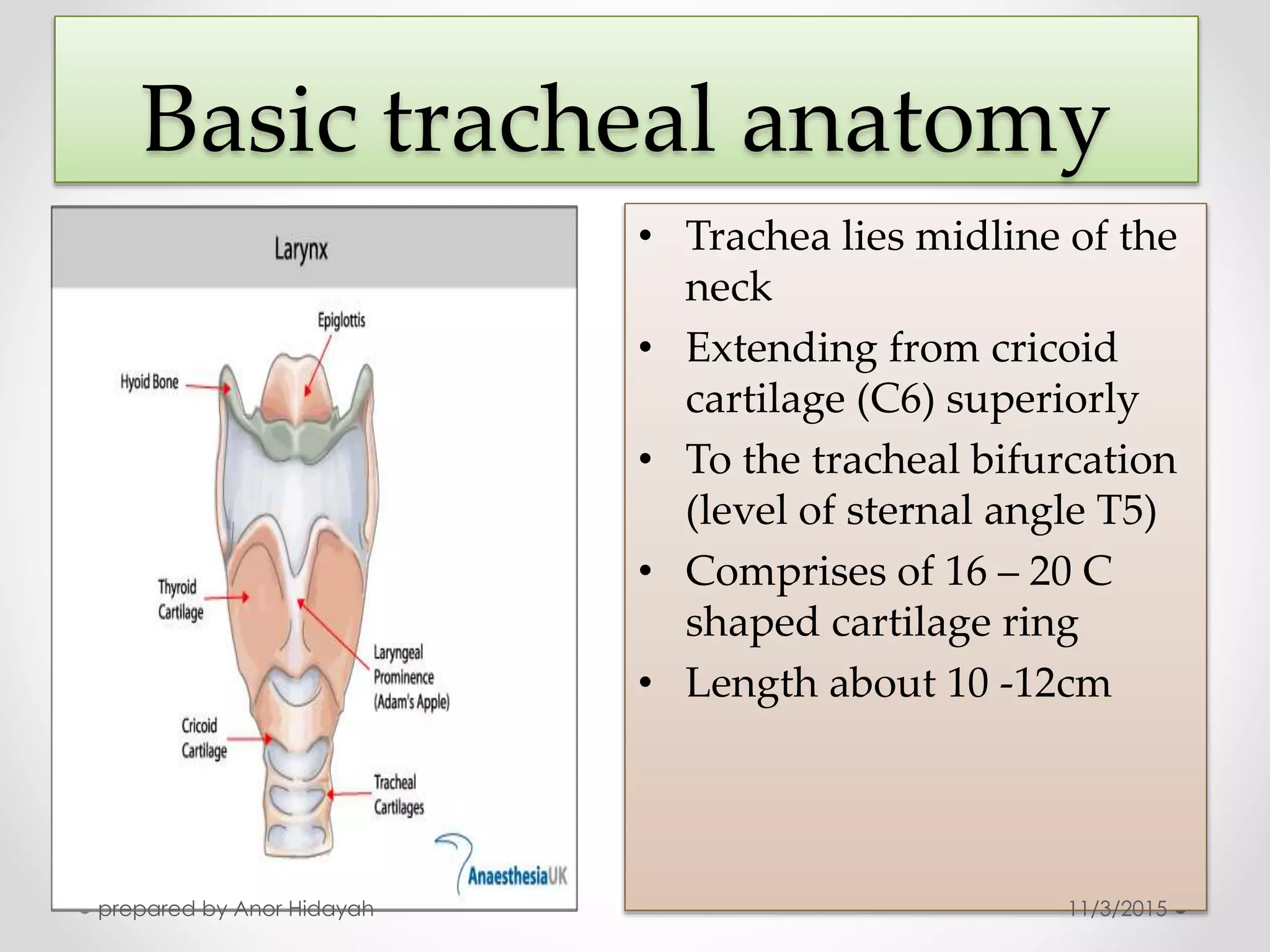 Percutaneous tracheostomy | PPTX