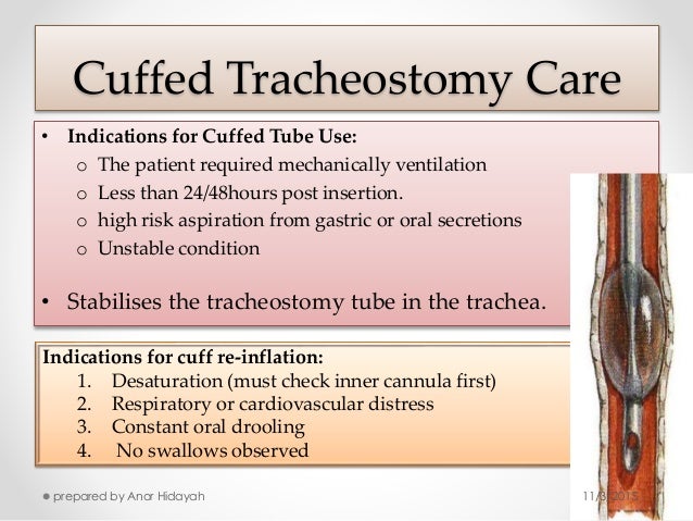 Percutaneous tracheostomy