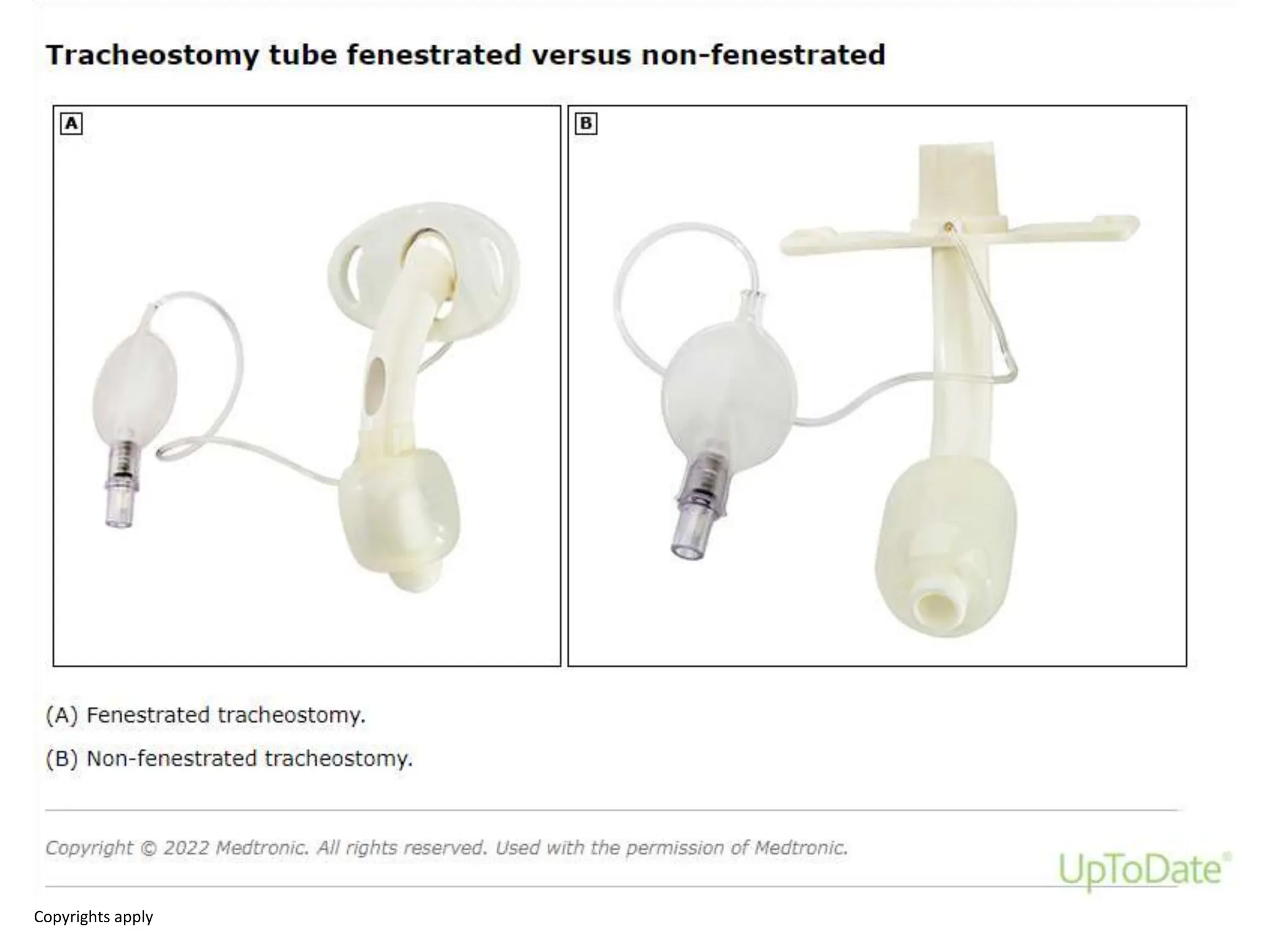 PERCUTANEOUS TRACHEOSTOMY- -NOV[1].pptx | Ear, Nose and Throat ...