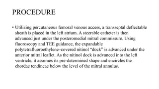 Percutaneous Transcatheter Mitral Valve Replacement | PPTX