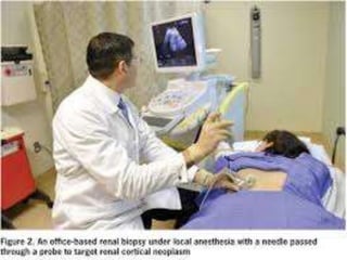 Percutanous renal biopsy | PPTX