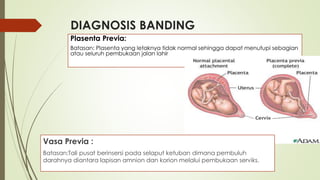 Perdarahan ante partum | PPTX