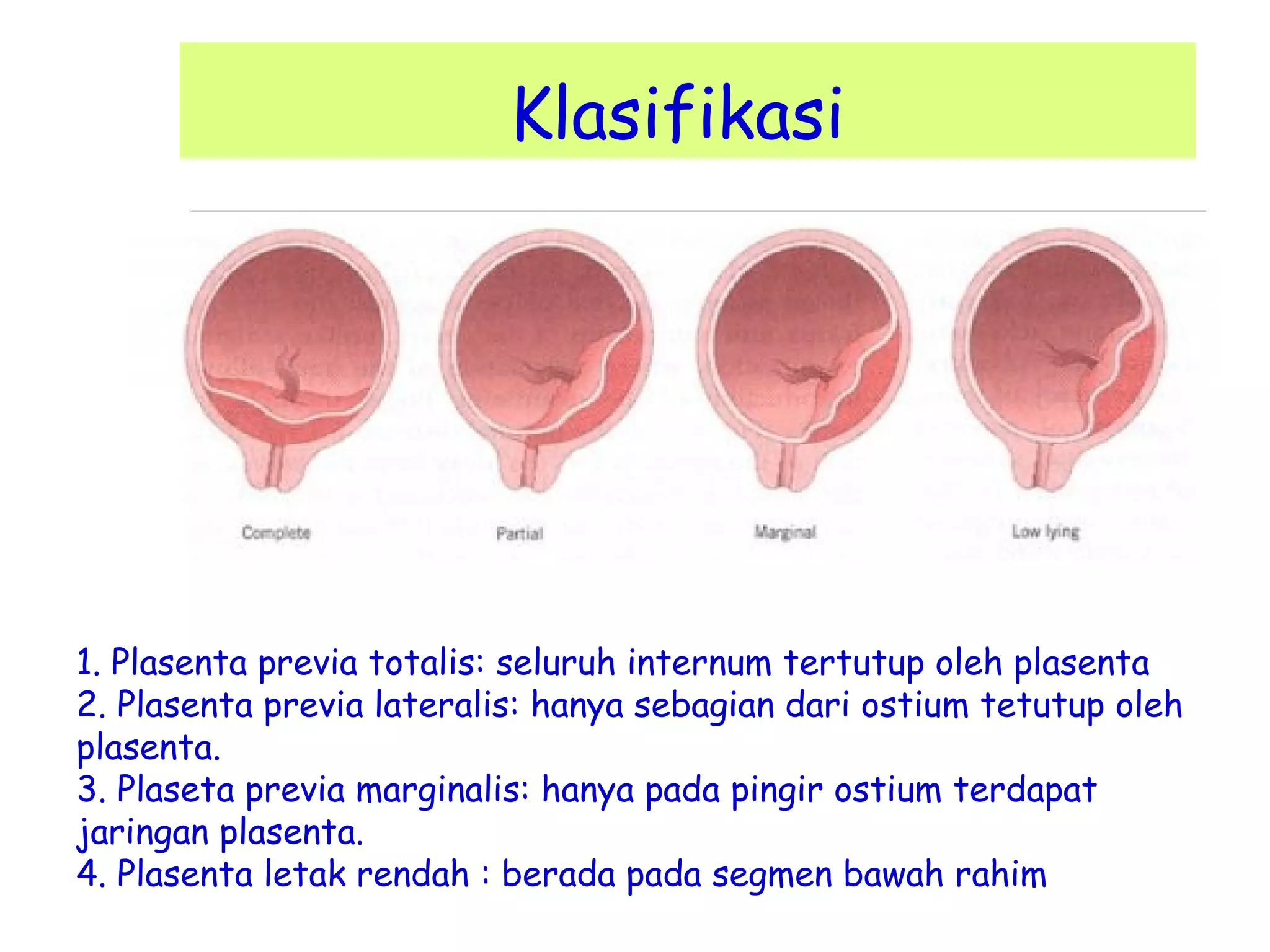 Perdarahan awal kehamilan | PPT