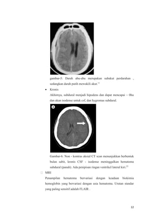 PERDARAHAN_INTRAKRANIAL.docx