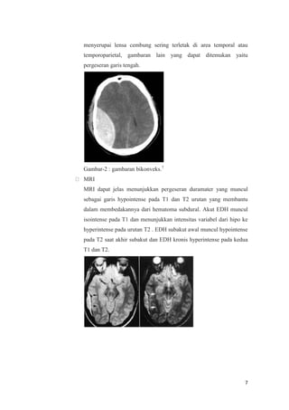 PERDARAHAN_INTRAKRANIAL.docx