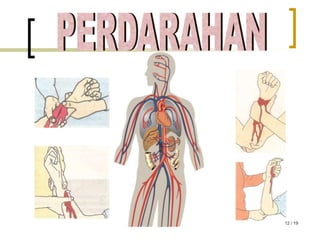 PERDARAHAN OL 9 OK.ppt