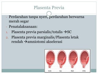 Perdarahan pada Kehamilan.pdf