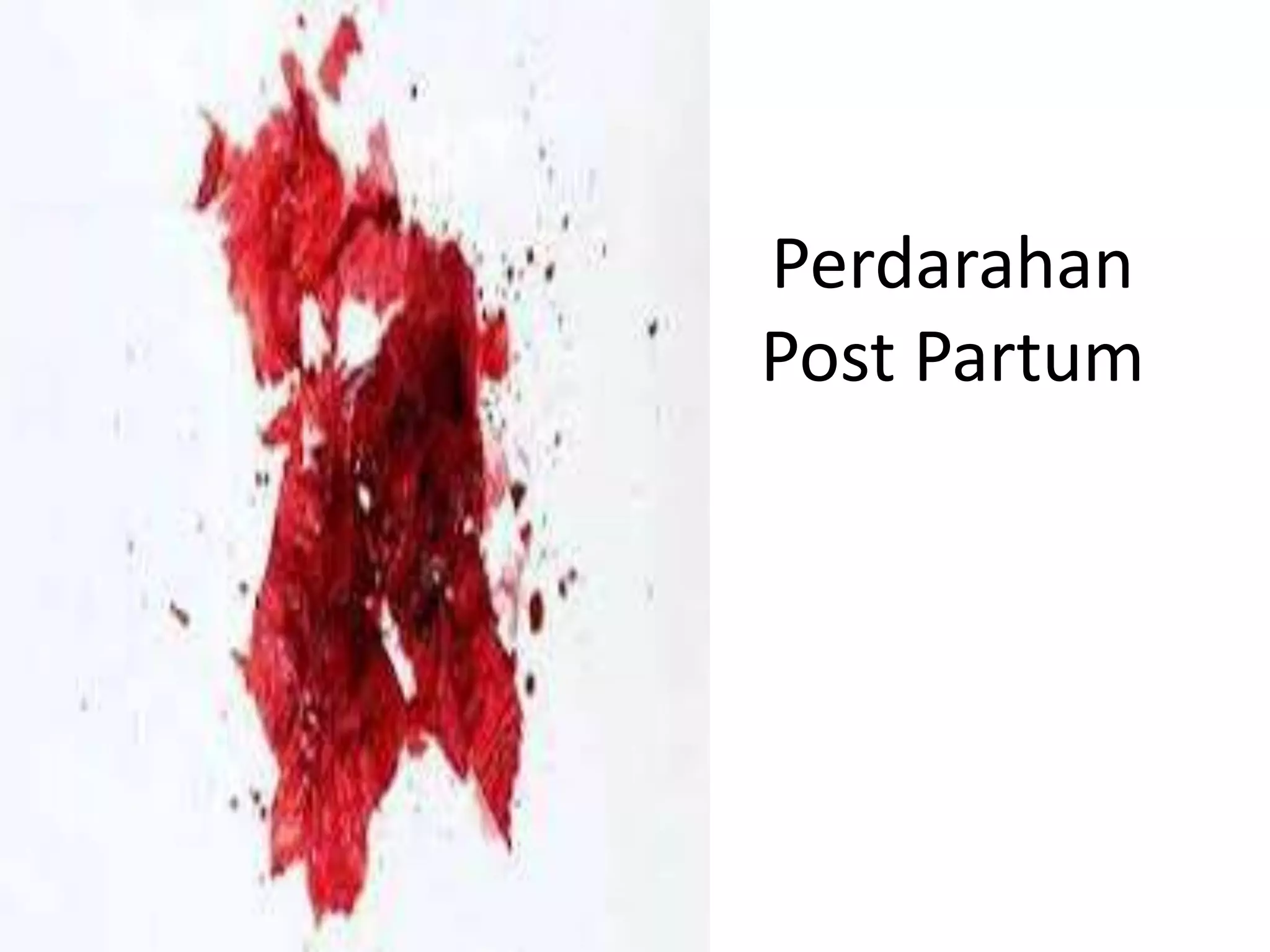 Perdarahan Post Partum | PPTX