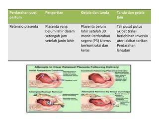 Perdarahan Post Partum | PPTX