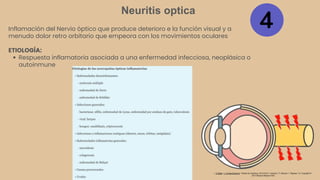 perdidavisualagudaOFTALMOLOGIA.pptx (1).pdf