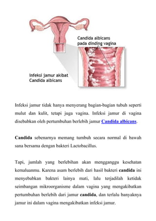 Perempuan!!! lakukan 20 cara mudah ini untuk menghilangkan gatal akibat ...