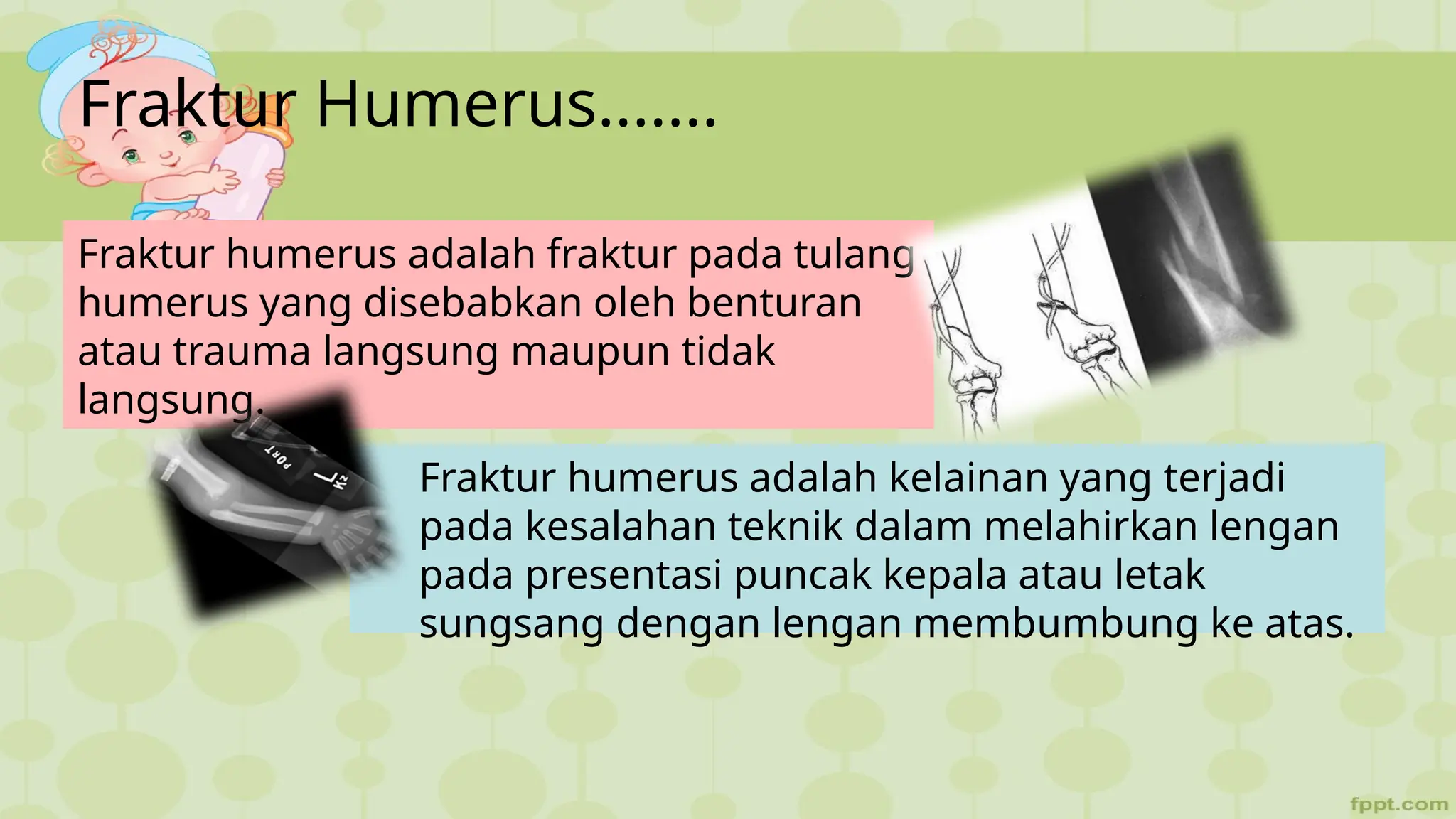 Caput sucadenum dan cephal hematom.pptxx | PPTX