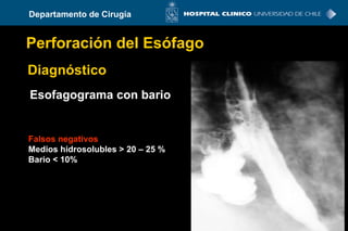 Perforación esofago | PPT