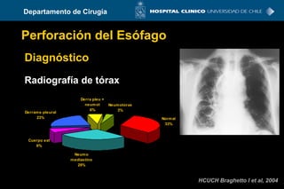 Perforación esofago | PPT