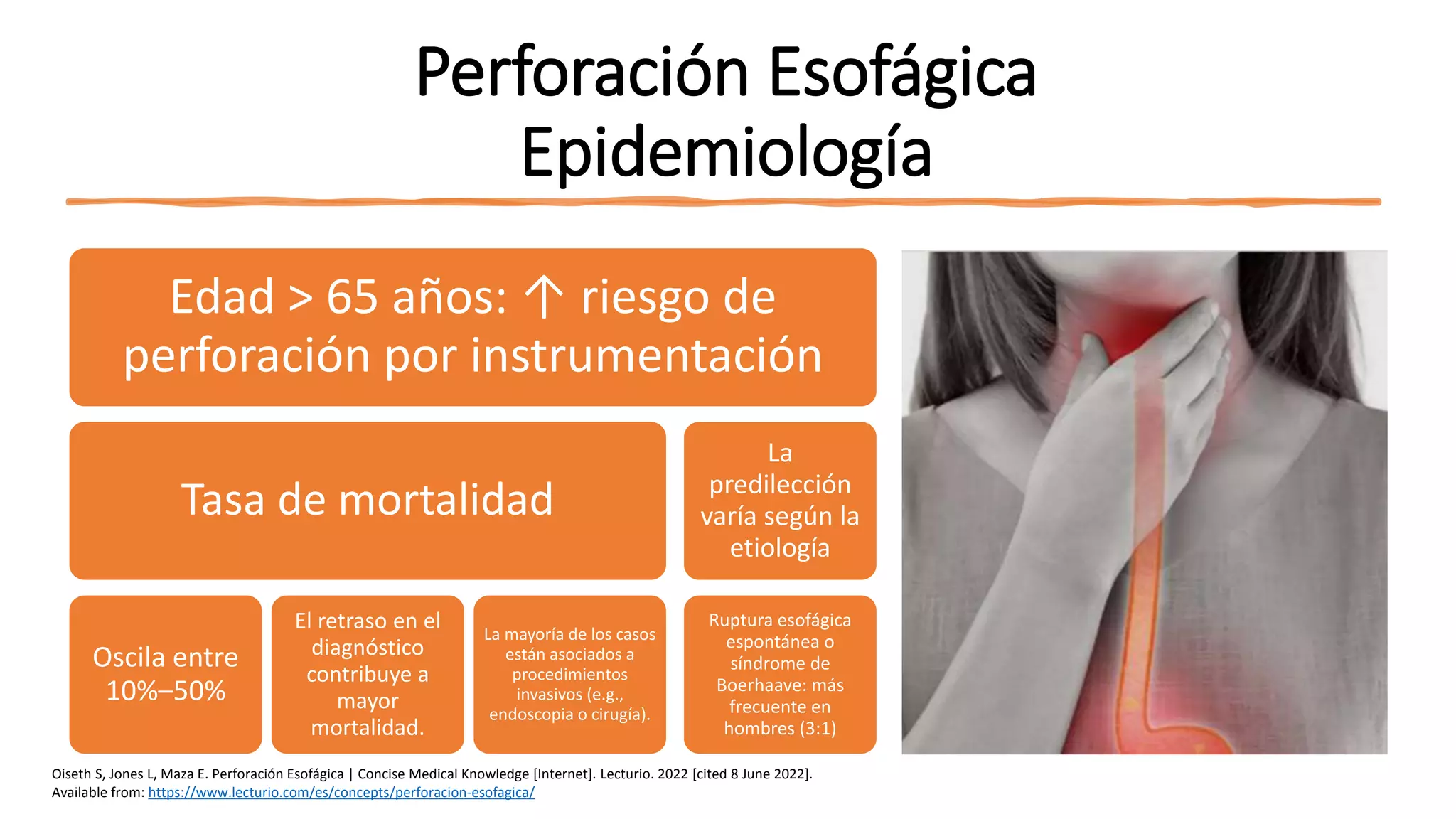 Perforación Esofágica - Cirugia UP - AH.pptx