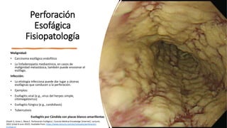 Perforación Esofágica - Cirugia UP - AH.pptx
