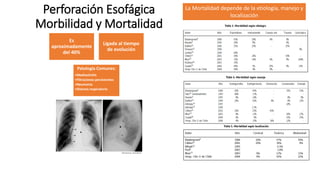 Perforación Esofágica - Cirugia UP - AH.pptx