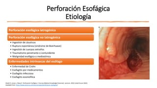 Perforación Esofágica - Cirugia UP - AH.pptx
