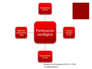 Perforacion esofagica | PPTX