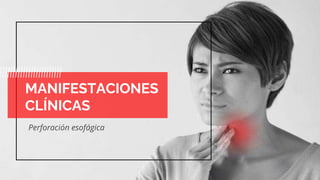 Perforacion esofagica | PPTX