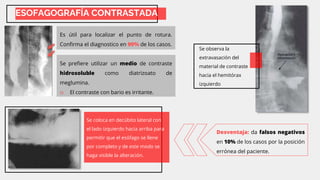 Perforacion esofagica | PPTX