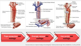 Perforacion esofagica | PPTX