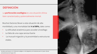 Perforacion esofagica | PPTX