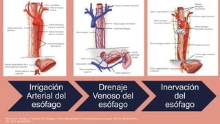 Perforacion esofagica | PDF