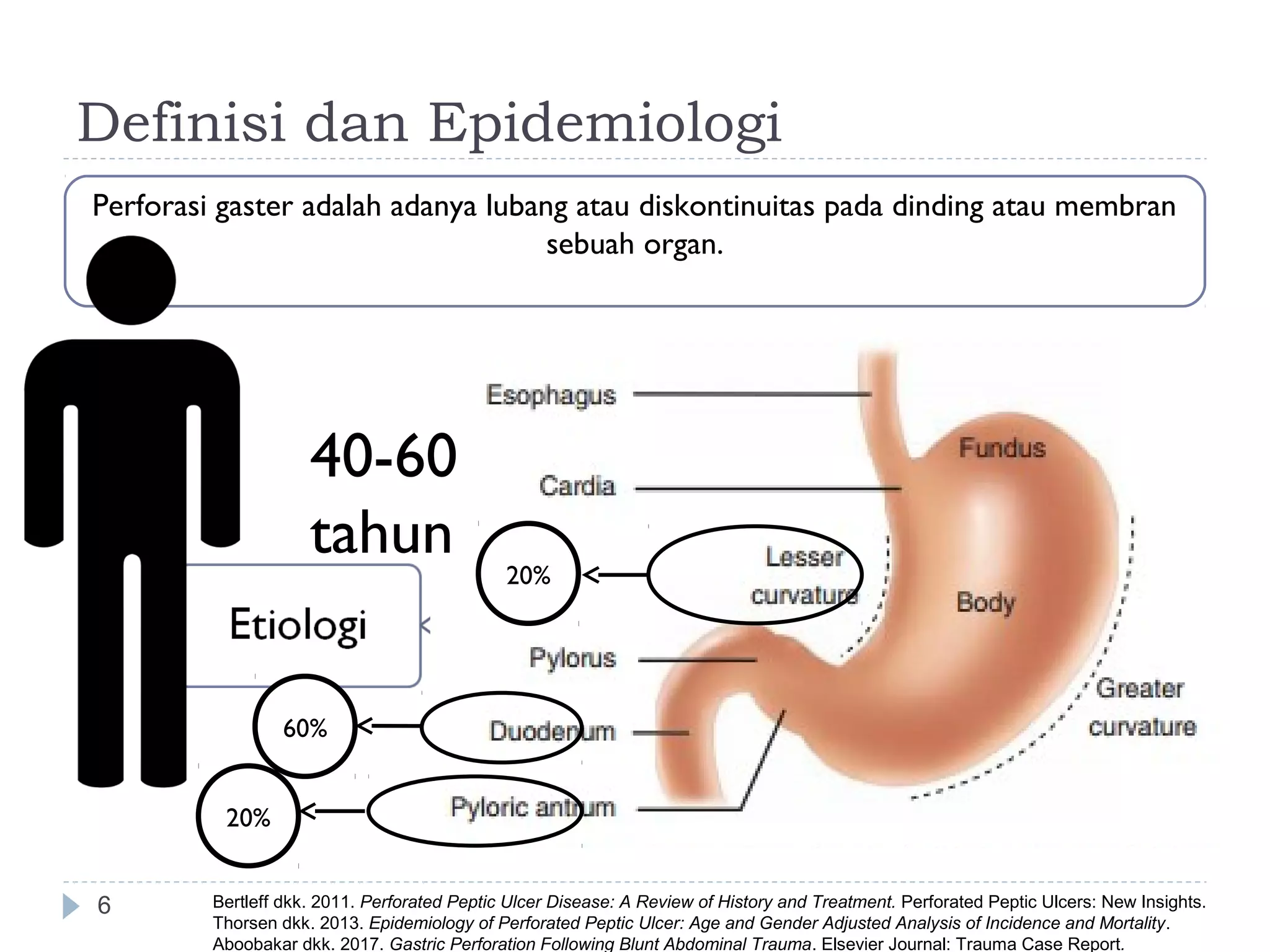 Perforasi gaster | PPT