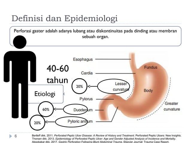 Perforasi gaster | PPT | Digestive Disorders | Diseases and Conditions