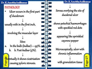 Perforated peptic ulcer by Dr.K.AmrithaAnilkumar | PPTX