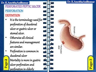 Perforated peptic ulcer by Dr.K.AmrithaAnilkumar | PPTX