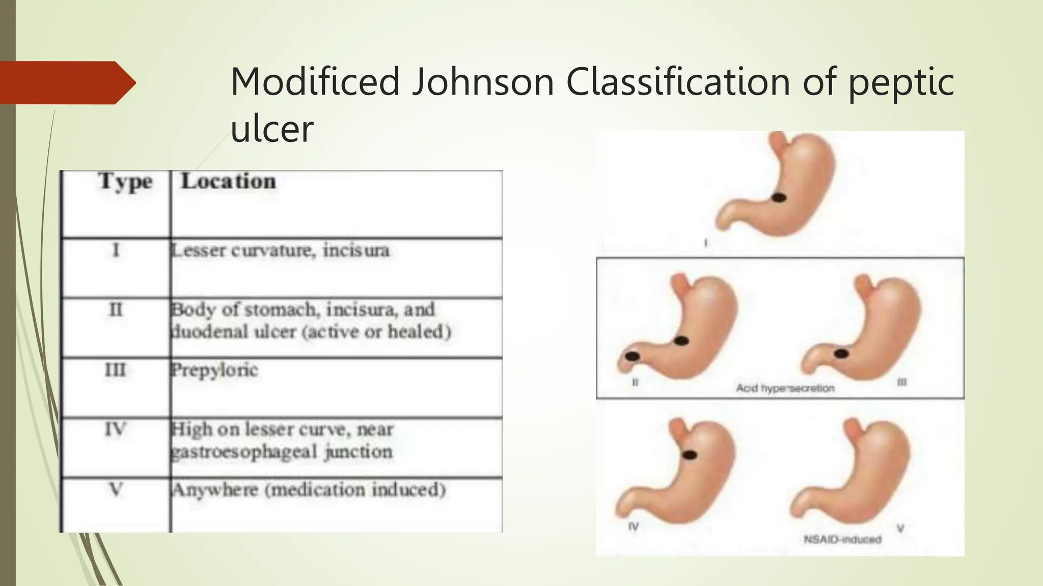 Perforated Peptic Ulcer.pptxuyfufhgdssgshdh | PPTX | Digestive ...