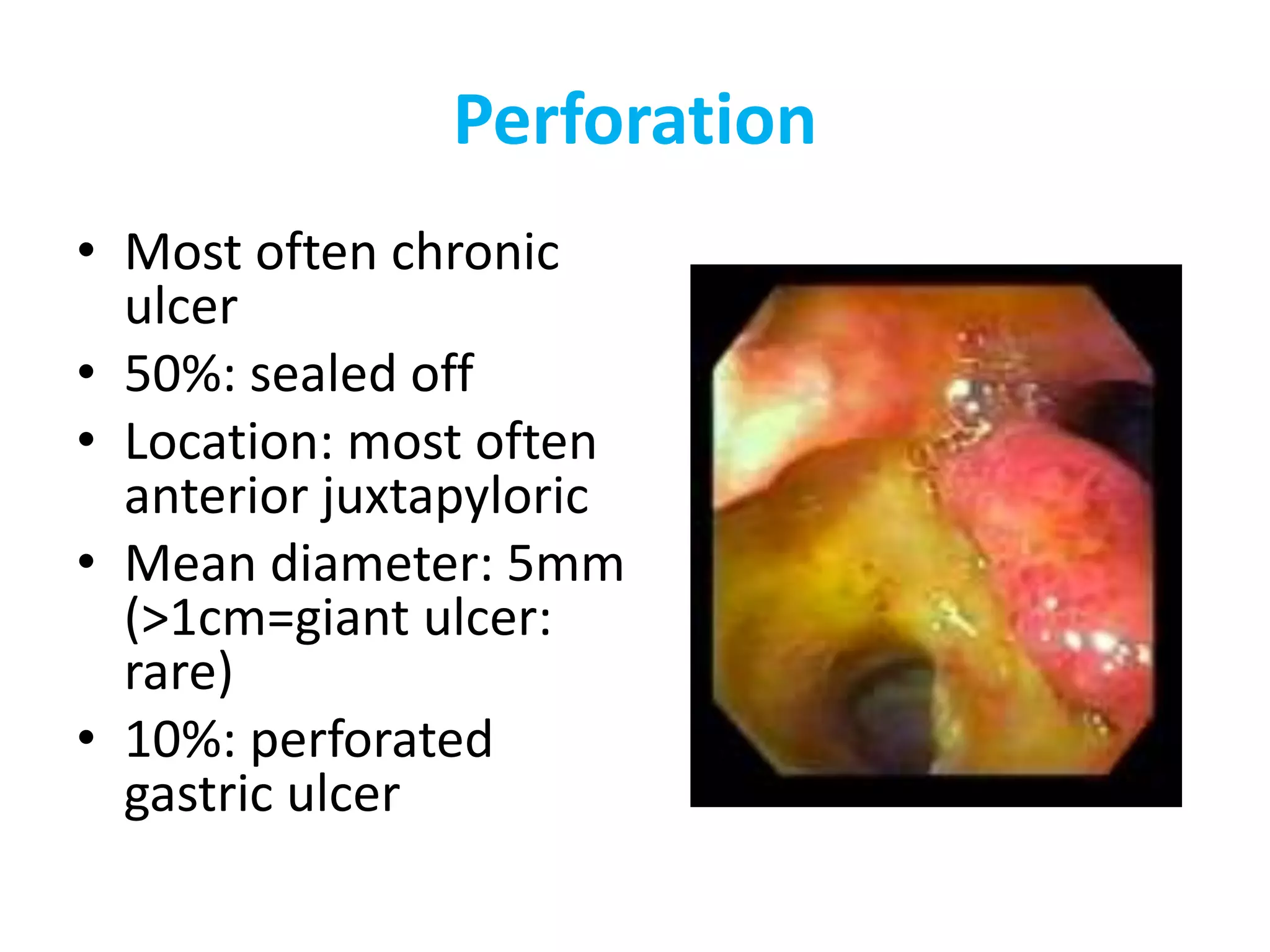 Perforation | PPTX