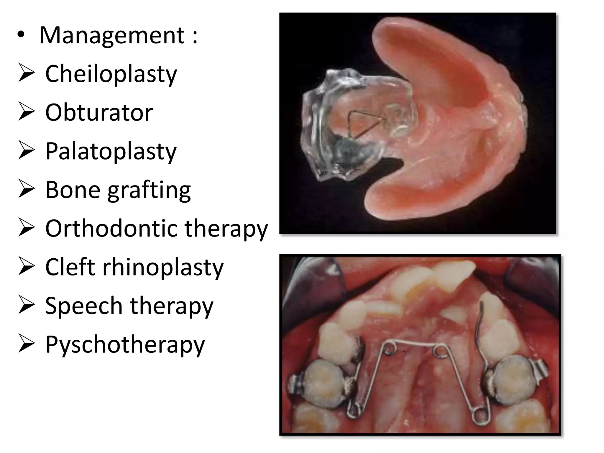 Perforation of palate | PPTX