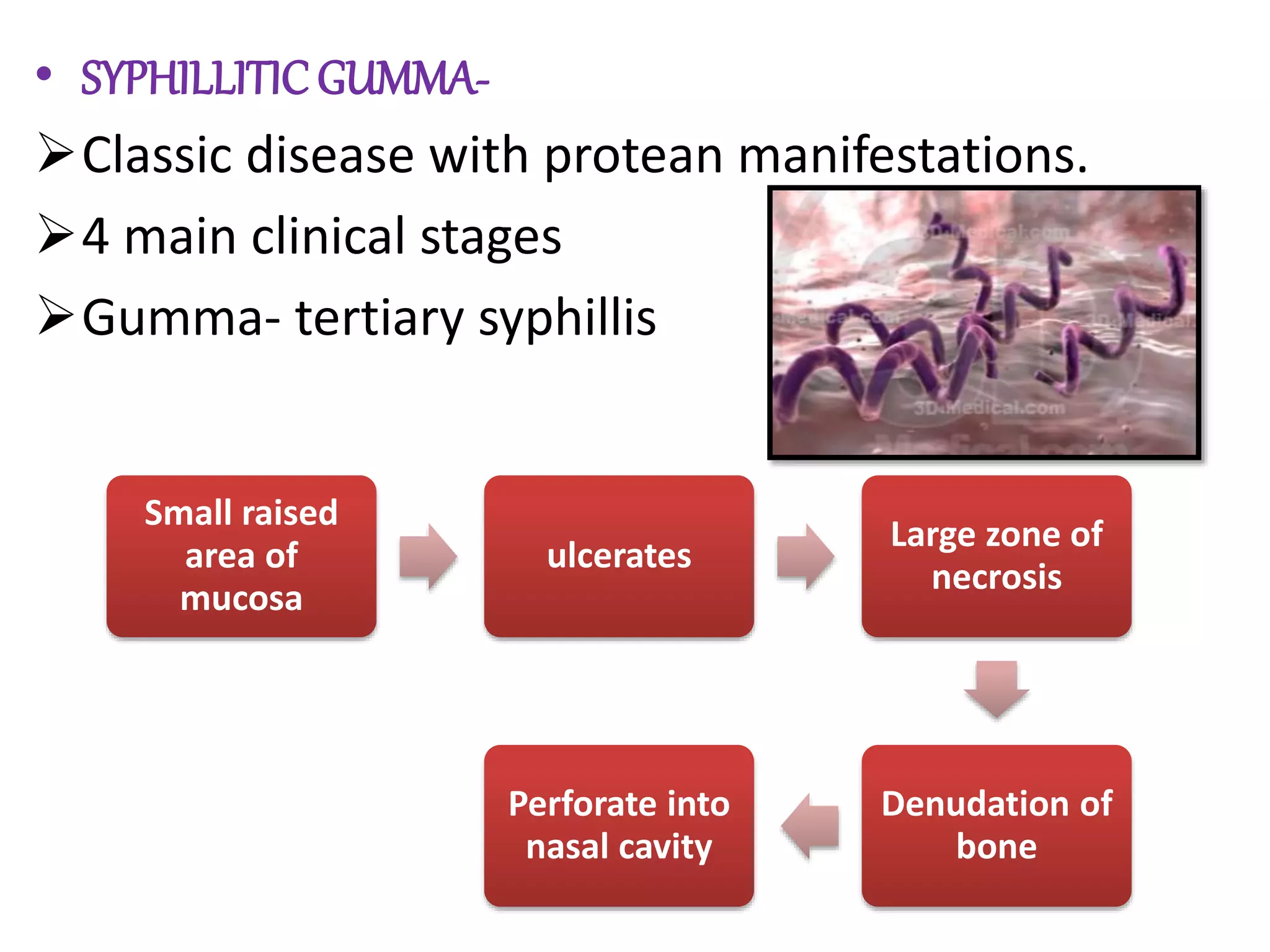 Perforation of palate | PPTX