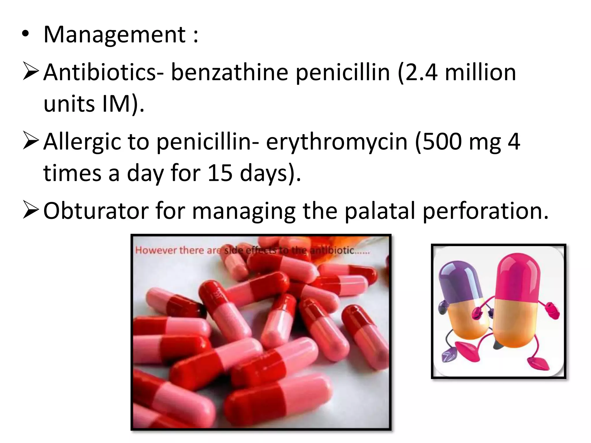 Perforation of palate | PPTX