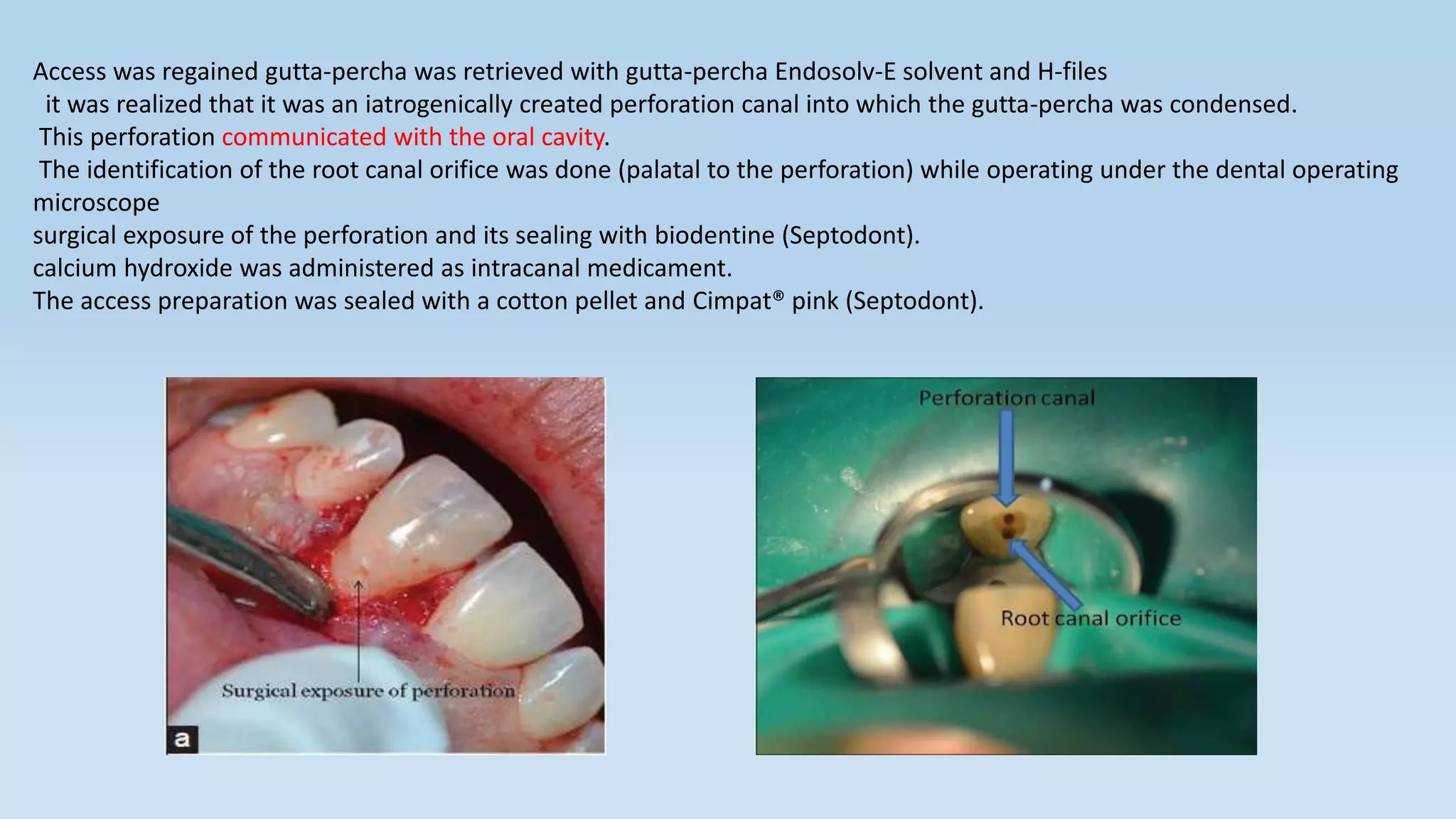 Perforations 3 | PPTX