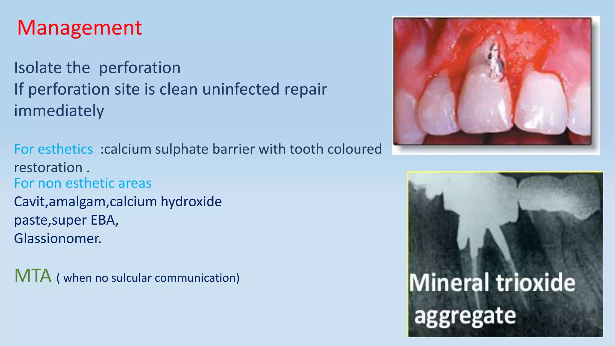 Perforations 3 | PPTX