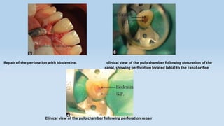 Perforations 3 | PPTX