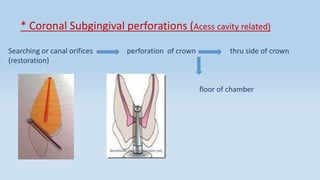 Perforations 3 | PPTX