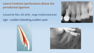 Perforations 3 | PPTX