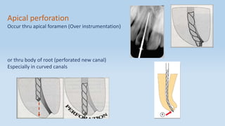 Perforations 3 | PPT
