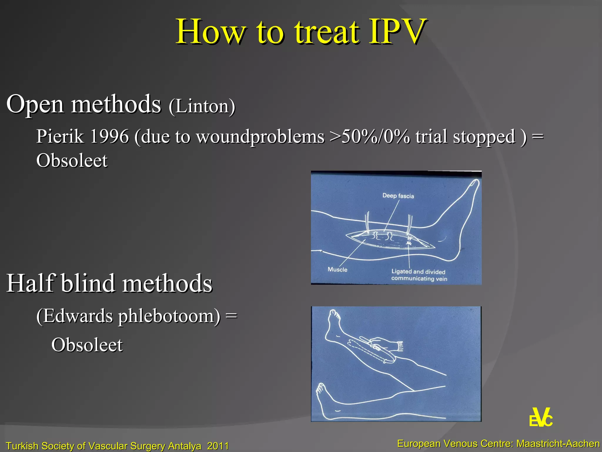Perforator veins why and how to treat them | PPT