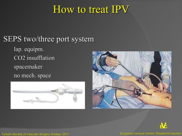 Perforator veins why and how to treat them | PPT | Blood Disorders ...