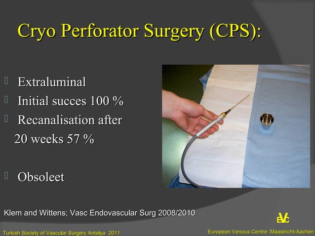 Perforator veins why and how to treat them | PPT | Blood Disorders ...