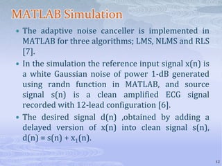 Performance analysis of adaptive noise canceller for an ecg signal | PPSX