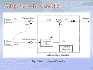 Performance analysis of adaptive noise canceller for an ecg signal | PPSX