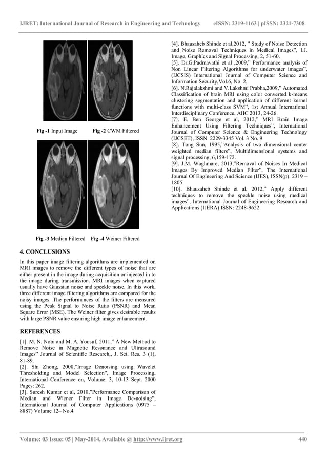 Performance Analysis Of Image Filtering Algorithms For Mri Images Pdf
